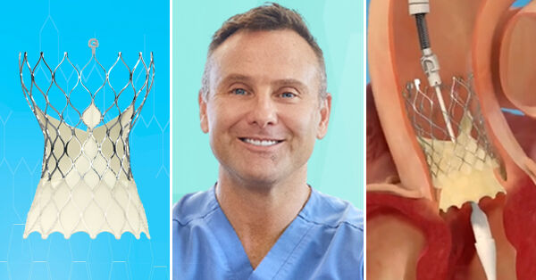 The TAVR Innovation: What Have We Learned?