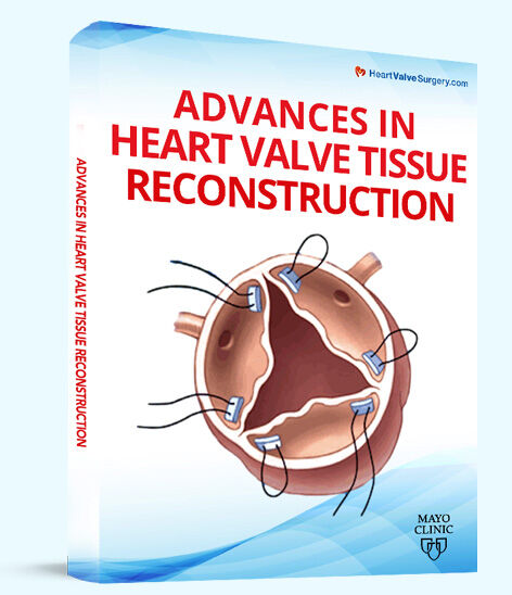 Free educational eBooks for Heart Valve Patients