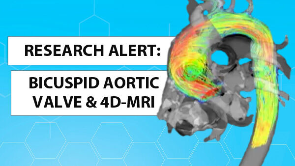 Bicuspid Aortic Valve: 4D Flow MRI for Aneurysm Detection