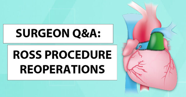 Ross Procedure Reoperations: What Should Patients Know?