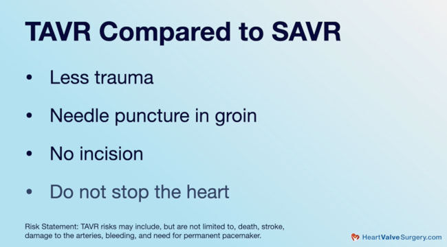 Doctor Q&A: 5 Must-Know Facts About TAVR for Aortic Valve Patients