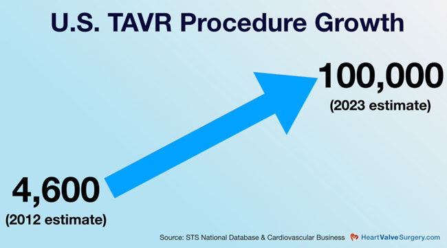 Doctor Q&A: 5 Must-Know Facts About TAVR for Aortic Valve Patients