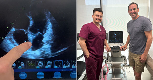 Annual Echocardiograms: Better Safe Than Sorry?