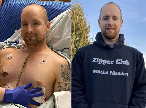 David & Andy Become Heart Surgery Brothers!