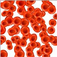 Anemia After Heart Surgery: Facts for Patients & Caregivers