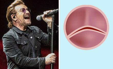 Learning Center for Heart Valve Disease & Surgery