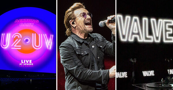 Bono, U2 & A Heart Disease Coincidence?