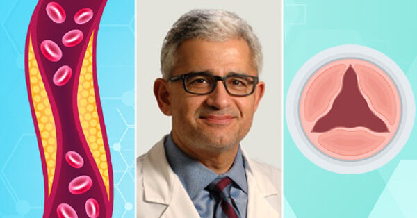 Doctor Q&A: Coronary Artery Disease & Heart Valve Disorders