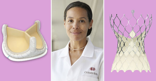 Surgeon Q&A: Surgical & Transcatheter Aortic Valve Insights