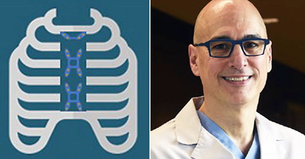 Research Alert: New Rapid Recovery Protocol for Sternotomy