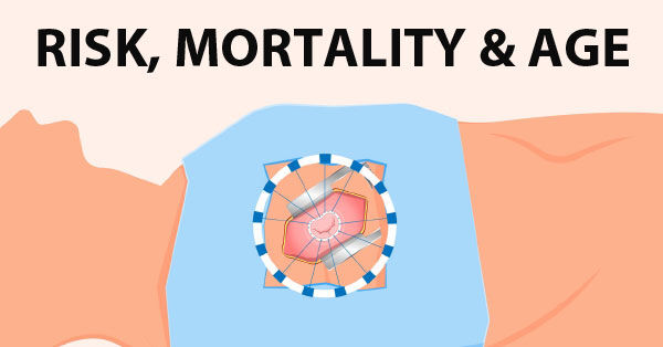 Surgeon Q&A: Heart Surgery Risks, Mortality & Age?