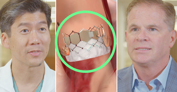 SAVR or TAVR: Facts for Bicuspid Aortic Valve Patients