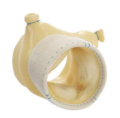 Adverse Effects Of Pig Valves For Heart Surgery Patients