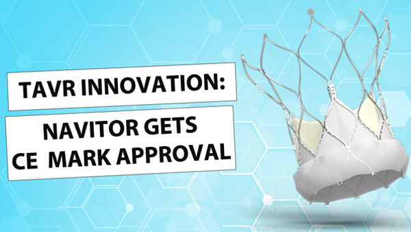 Adam's Heart Valve Surgery Blog for Patients