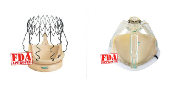 Top 10 Heart Valve Stories of 2016!