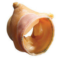 Why Are Pig Valve Replacements Still Used?