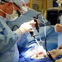 Restarting The Heart After Cardiac Surgery