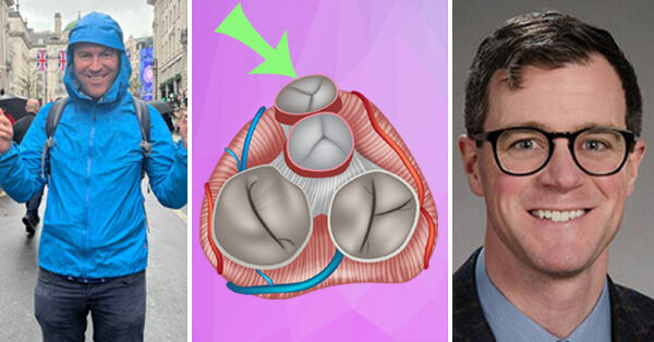 Ross Procedure - Adam’s Heart Valve Surgery Blog