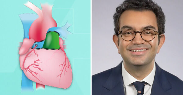 Surgeon Q&A: What About Ross Procedure Reoperations?