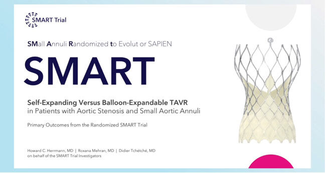 Women's Heart Health Alert: SMART Clinical Trial and Aortic Stenosis