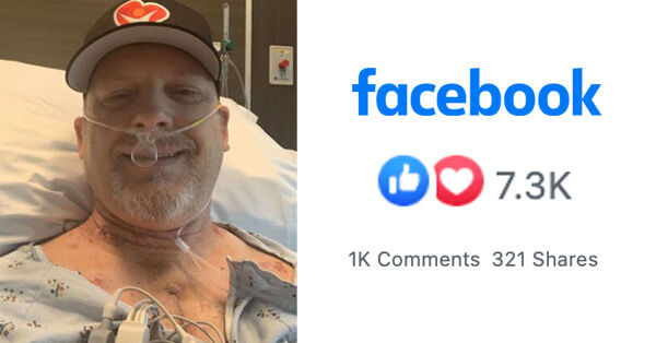 Smiling Scar Selfie Alert: Michael's Snap Goes Viral