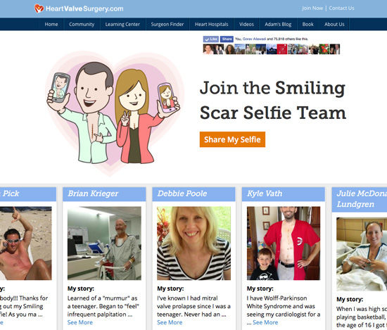 Launching Now: Smiling Scar Selfie Team!!!