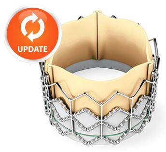 Surgeon Q&A: Understanding TAVI with Dr. Michael Mack