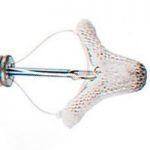 Cow Valve Replacements: Patient Information about Bovine Valves