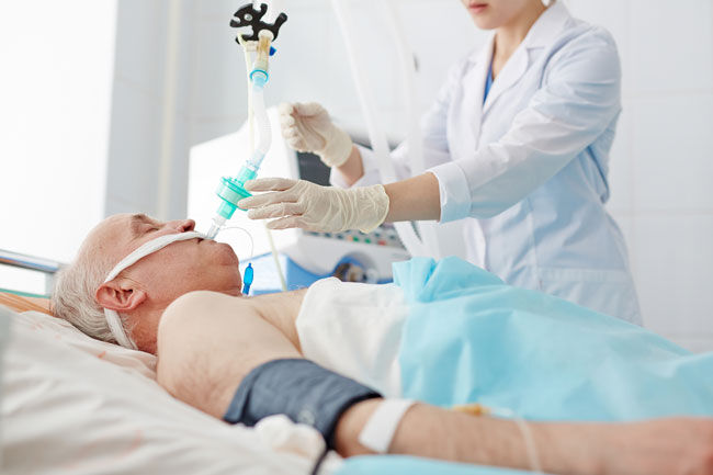 Surgeon Q&A: Ventilator Tube Removal After Heart Surgery